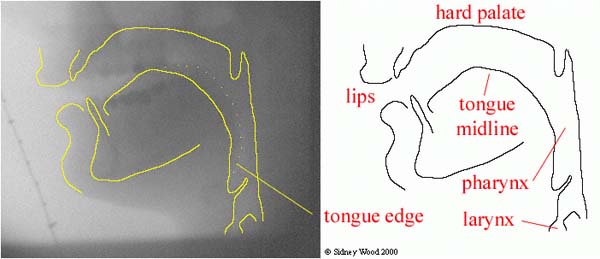 Tracking movement | Welcome to SWPhonetics